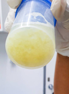 Despre spută, examenul sputei și cum identifică bolile respiratorii ...