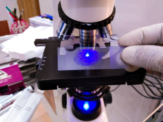 Despre spută, examenul sputei și cum identifică bolile respiratorii ...